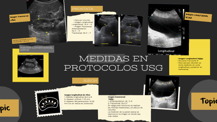 MEDIDAS EN PROTOCOLOS by GETZABEL ISAMAR XALCUACO BONILLA on Prezi