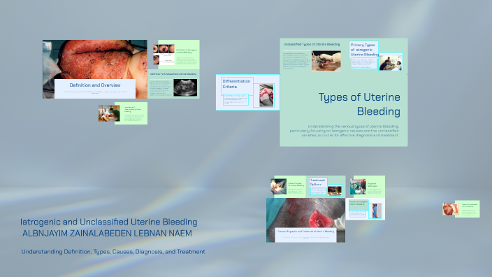 Iatrogenic and Unclassified Uterine Bleeding by zainalabeden lebnan on ...