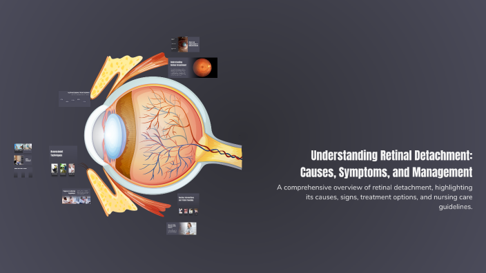 Understanding Retinal Detachment: Causes, Symptoms, and Management by ...