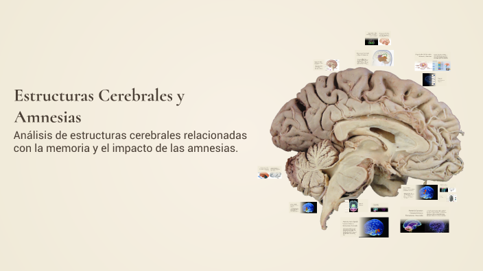 Estructuras Cerebrales y Amnesias by ASTRID AVRIL BERNAL MONTAÑEZ on Prezi