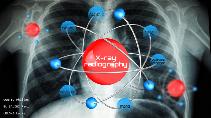 X-ray radiography by Lucie Lelong on Prezi