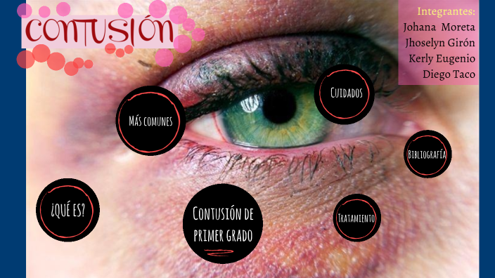 CONTUSIÓN DE PRIMER GRADO by Jhoselyn Giron on Prezi