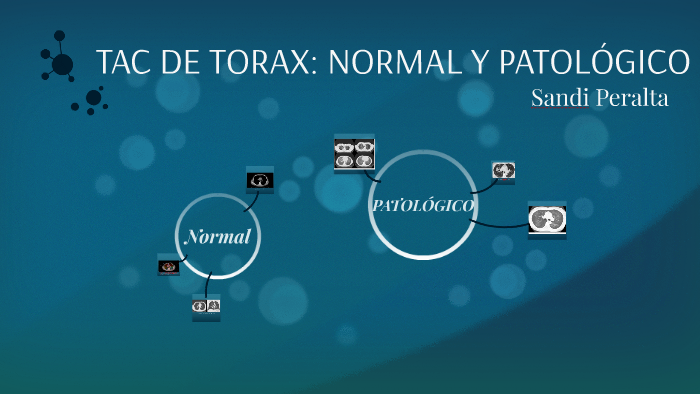 TAC DE TORAX: NORMAL Y PATOLÓGICO by Sandi Carolina Peralta Mejía on Prezi