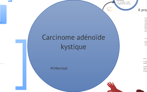 Carcinome adénoïde kystique by maxime mermod on Prezi