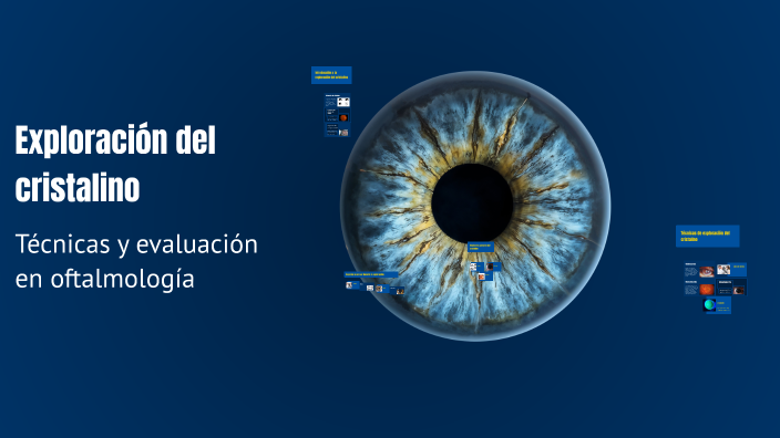 Exploración del cristalino by Salinas Angel Irvin Alberto on Prezi