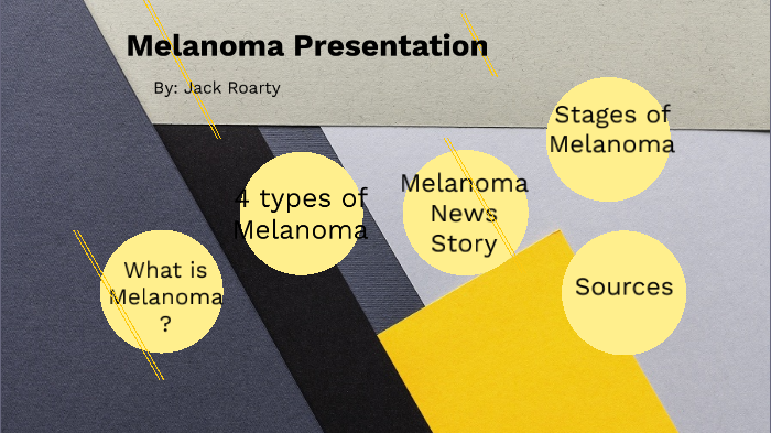 Melanoma Project by John Roarty on Prezi