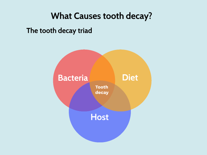 Tooth decay triad by Marcio Laguna Carrasco on Prezi