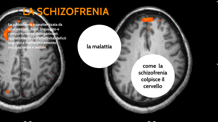 schizz by melcy gonzalez on Prezi