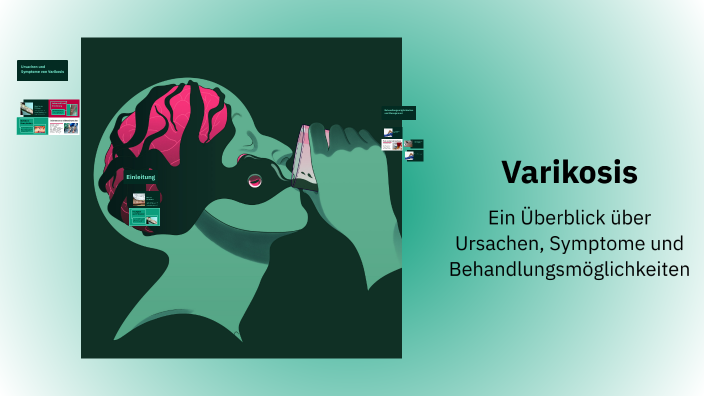 Varikosis by Matilda Boateng on Prezi