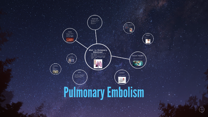Pulmonary Emboli by Austin Buhler on Prezi