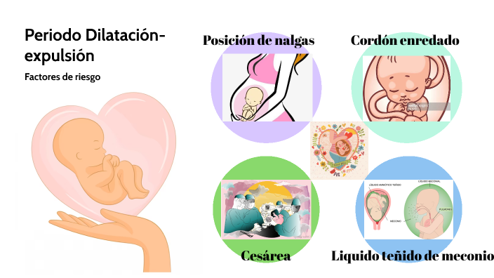 Factores de riesgo en Dilatación-expulsión by Maria Del Carmen Alcazar ...