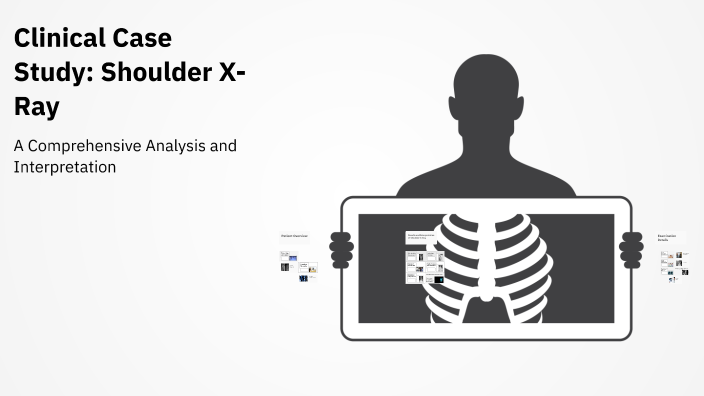 Clinical Case Study: Shoulder X-Ray by Emony Bell on Prezi