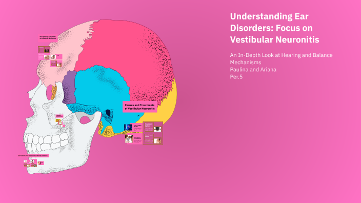 Understanding Ear Disorders: Focus on Vestibular Neuronitis by Ariana ...