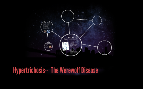 Hypertrichosis-- The Werewolf Disease by Pepper Demooney on Prezi