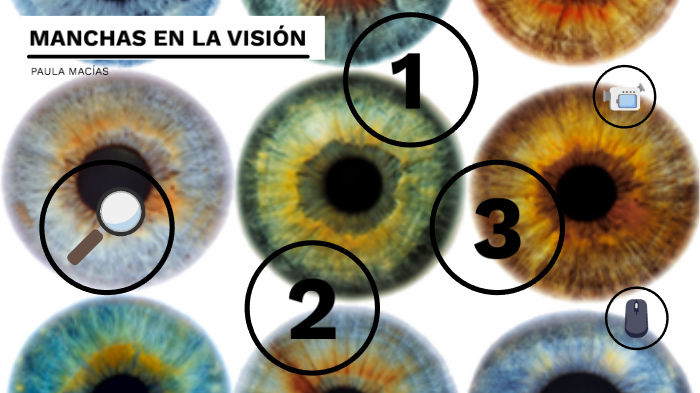 MANCHAS EN LA VISIÓN by Paula Macías on Prezi