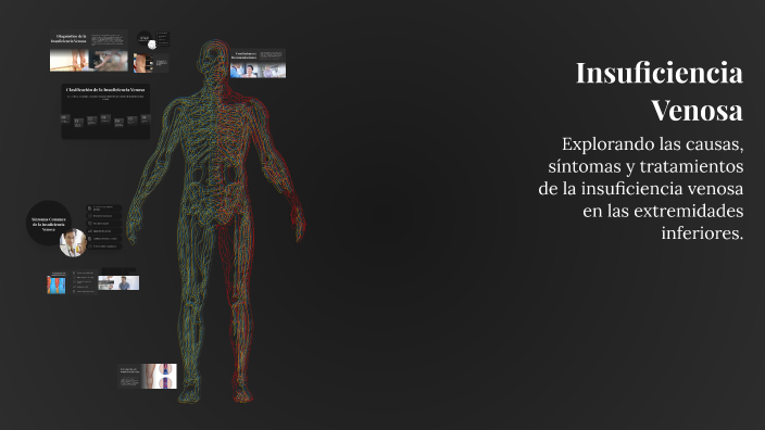 Insuficiencia Venosa by angel stalin mejia ramirez on Prezi