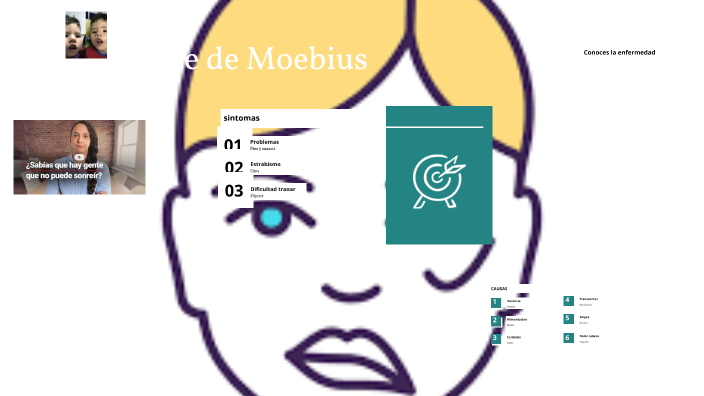 Congénita parálisis facial no progresiva by INA CR on Prezi