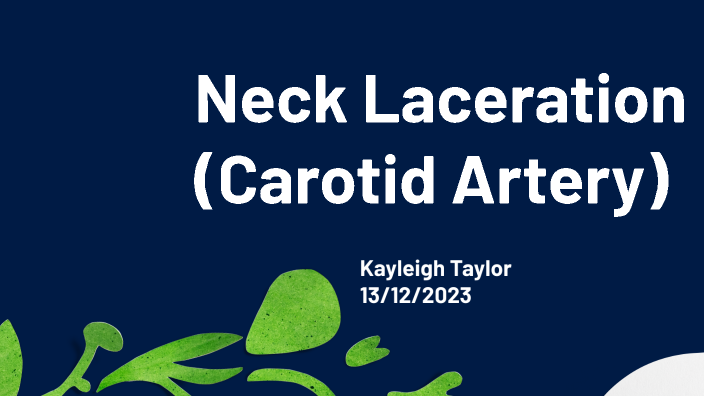 Laceration On the Neck (Carotid Artery) by Kayleigh Taylor on Prezi