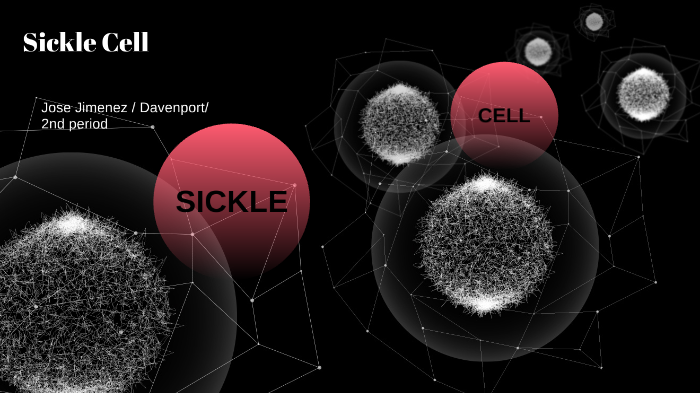 Sickle Cell Disease Project by Jose Jimenez on Prezi