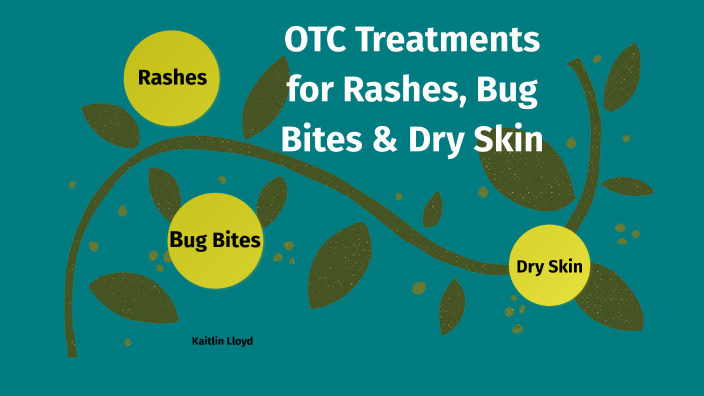 OTC Treatments for Dry Skin, Rashes and Bites by Kaitlin Lloyd on Prezi