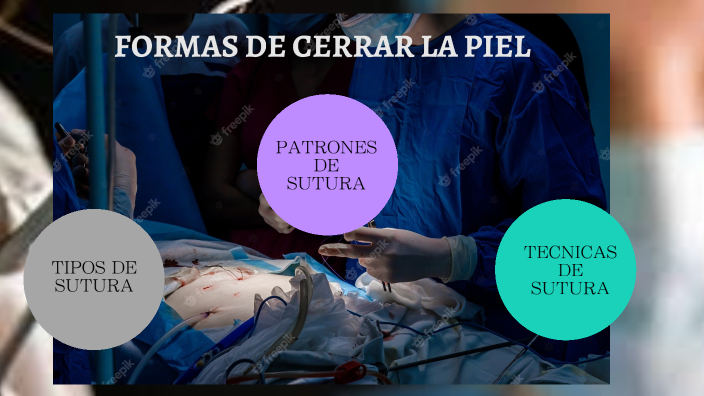 FORMAS DE CERRAR LA PIEL by Alex Fernando M on Prezi
