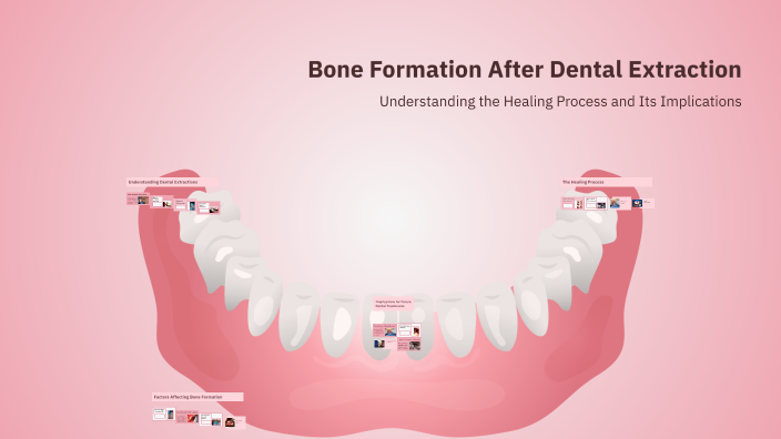 Bone Formation After Dental Extraction by Nada Ibrahim on Prezi