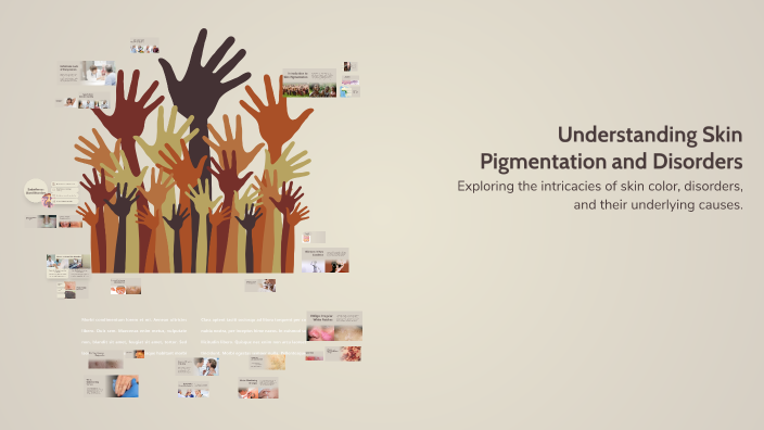 Understanding Skin Pigmentation and Disorders by Rebecca Mendoza on Prezi