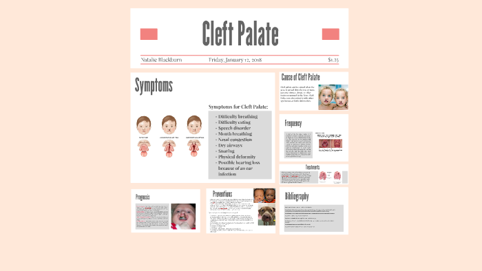 Cleft Palette by on Prezi