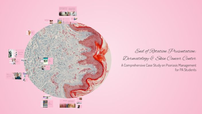 End of Rotation Presentation: Dermatology & Skin Cancer Center by Tommy ...