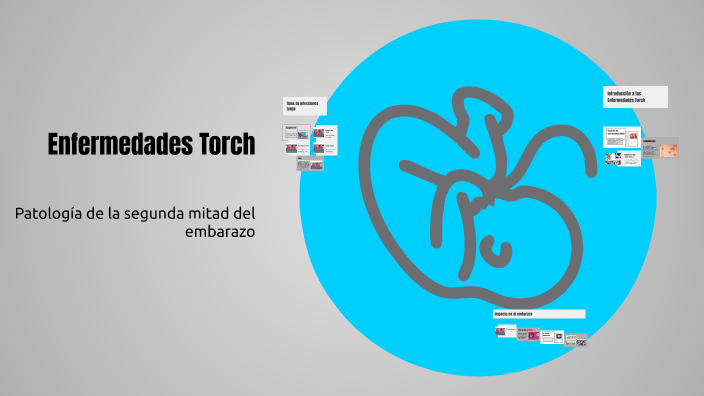 Enfermedades Torch by Wilder Ramirez on Prezi