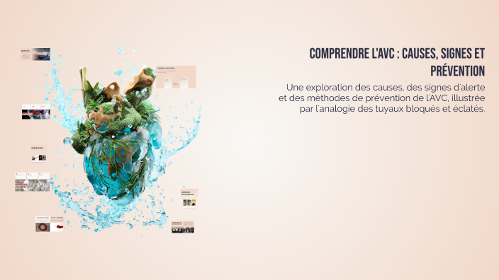 Comprendre l'AVC : Causes, Signes et Prévention by becky Kapulay on Prezi