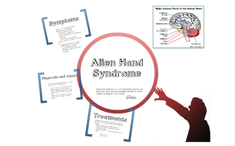 Alien Hand Syndrome by kolby anderson on Prezi