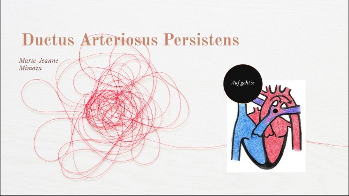 Ductus Arteriosus Persistens by imakaveli7 on Prezi
