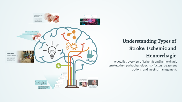 Understanding Types of Stroke: Ischemic and Hemorrhagic by Mary Mathew ...