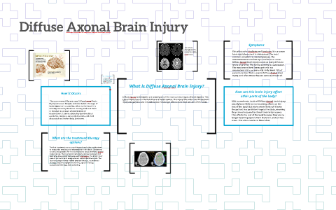 Diffuse Axonal Brain Injury by Jessica Martin on Prezi