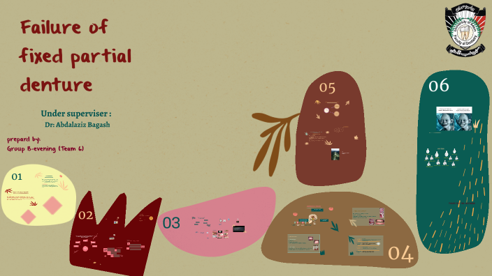 Failure of fixed partial denture by Yussra Salem on Prezi