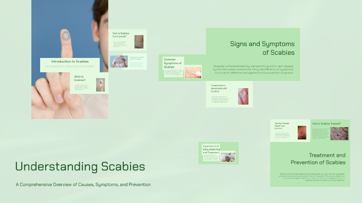 Understanding Scabies by Toni Williams on Prezi