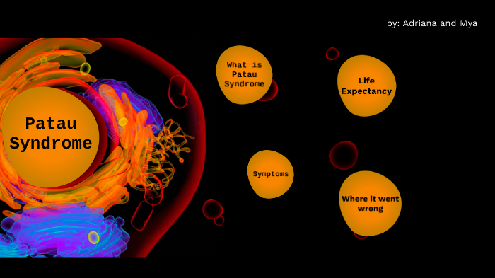 Patau Syndrome by mya yee on Prezi