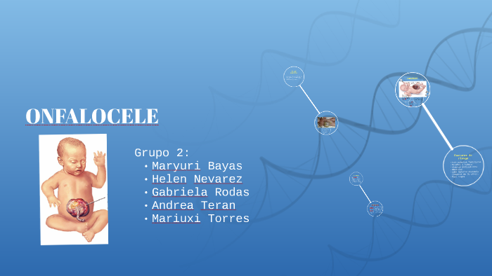 ONFALOCELE by gabriela rodas