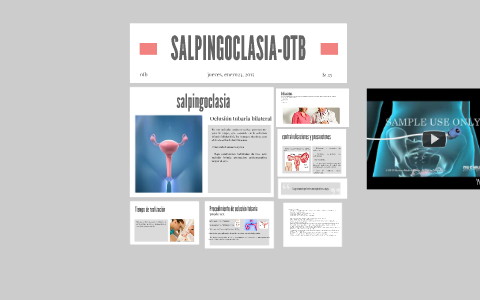 SALPINGOClASIA-OTB by nitzy Gutierrez on Prezi
