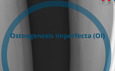 Osteogenesis Imperfecta Presentation by Ethan Rickett on Prezi