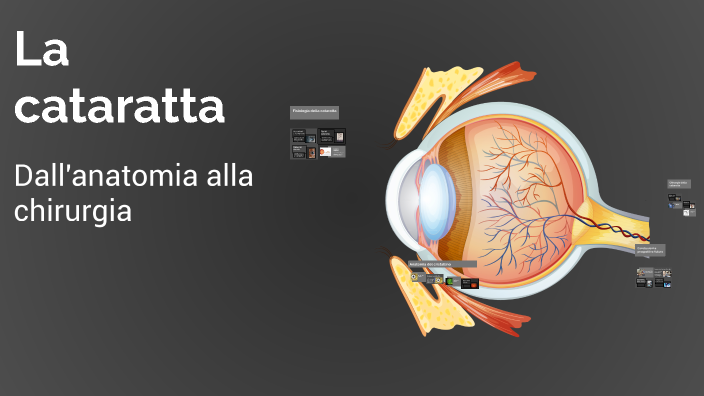 La cataratta by Danilo Iannetta on Prezi