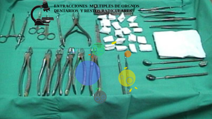 EXTRACCIONES MULTIPLES by Gerson Ramirez on Prezi