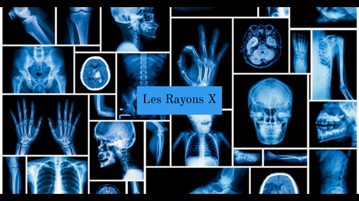 rayons X by alice vangeel on Prezi