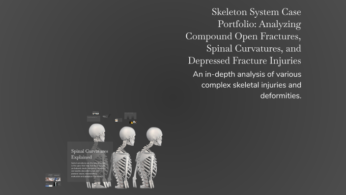 Skeleton System Case Portfolio: Analyzing Compound Open Fractures ...