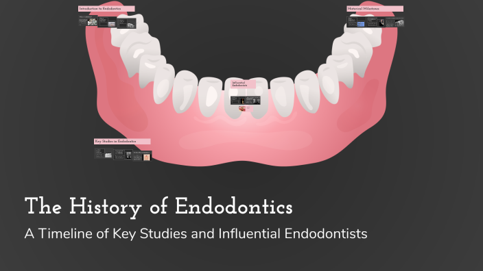 The History of Endodontics by Elise DeDominicis on Prezi
