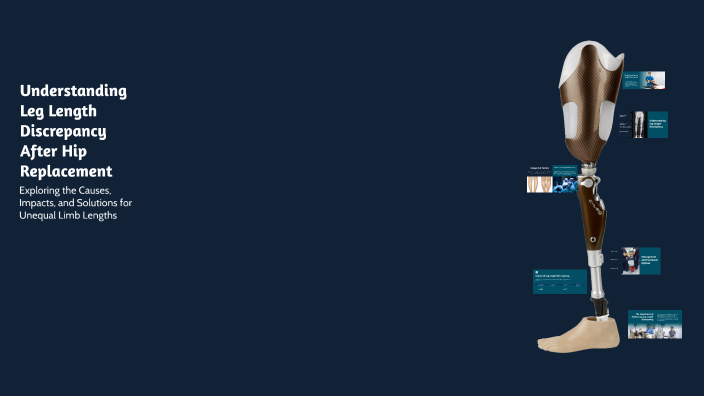 Understanding Leg Length Discrepancy After Hip Replacement by Abrar ...