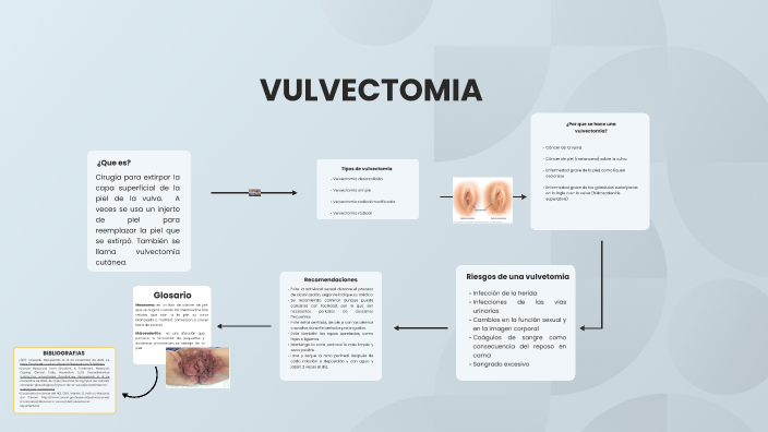 Vulvectomia by Paola Montserrat Carrillo on Prezi