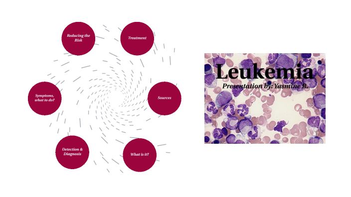 Leukemia Report by Yasmine Reda on Prezi