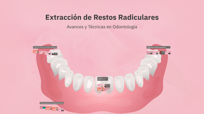 Extracción de Restos Radiculares by Jonathan Tlalmis Zempoalteca on Prezi
